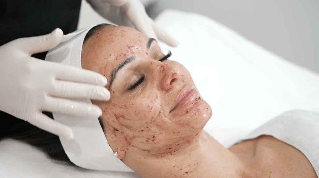 Acne Treatments | Sydney & Brisbane | Contour Clinics