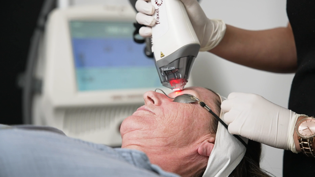 1540 Fractional Non-Ablative Laser - Contour Cosmetic Clinics