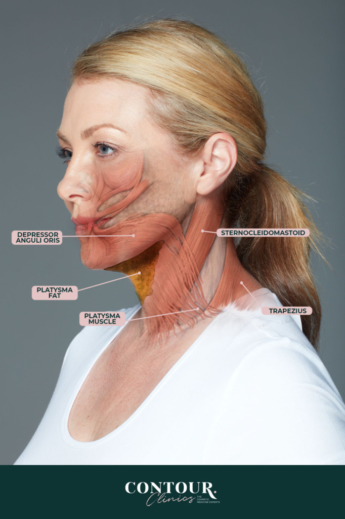Under-Chin Sculpting | Contour Clinics