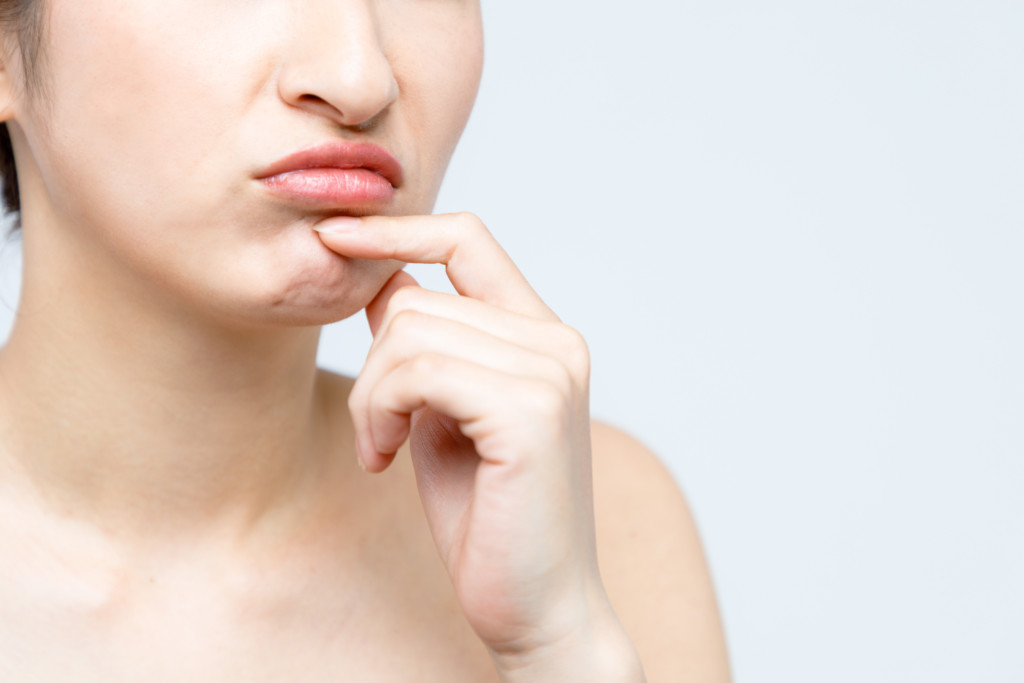 Chin Crease & Dimpling Treatment | Smooth Chin Dimples, Lines ...