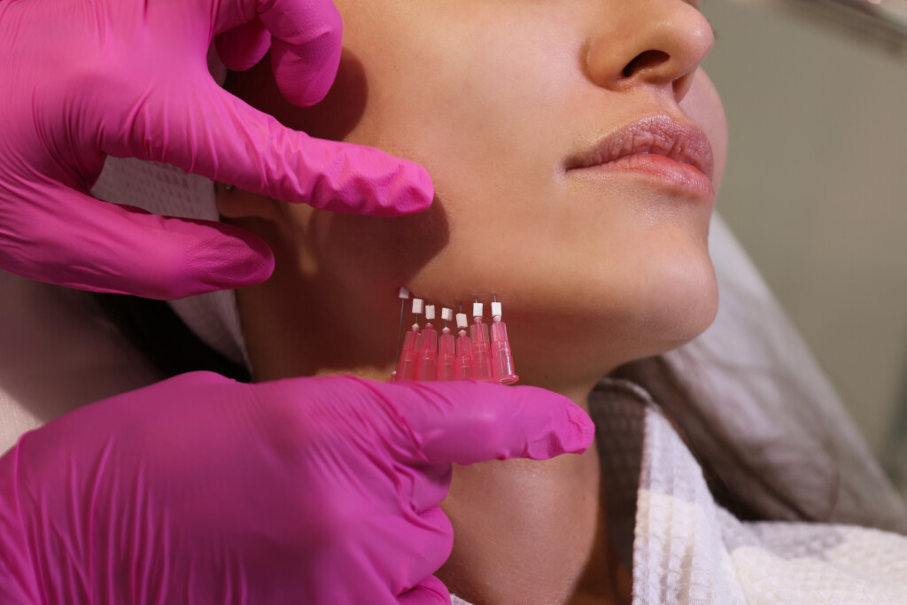 Thread Lift Sydney | Thread Face Lift | Contour Clinics