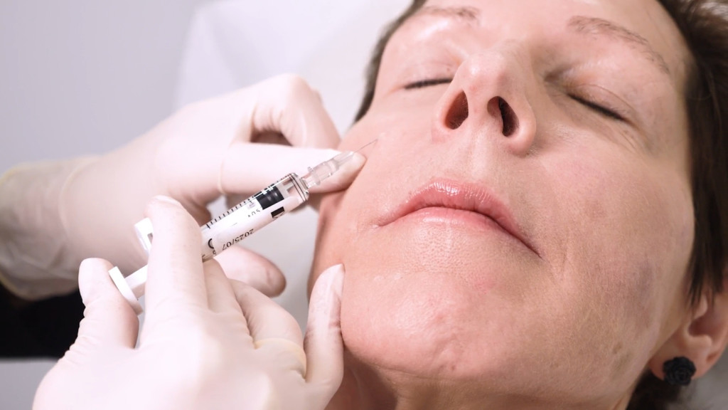 Bioremodeller Injections | Contour Clinics | Sydney, Australia