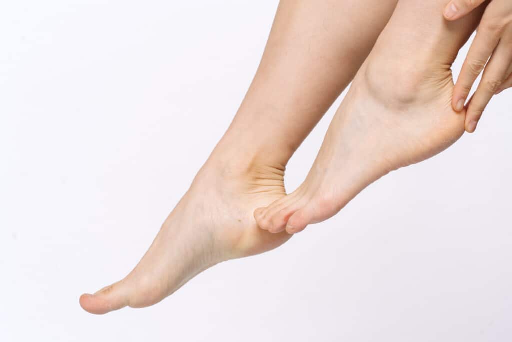 Excessive Feet Sweating Treatment | Contour Clinics