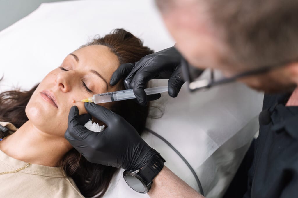 Mole Removal Sydney | Remove Moles with No Scar | Cosmetic Doctors