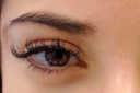 Fox Eye & Cat Eye Thread Lifts Sydney | Contour Clinics